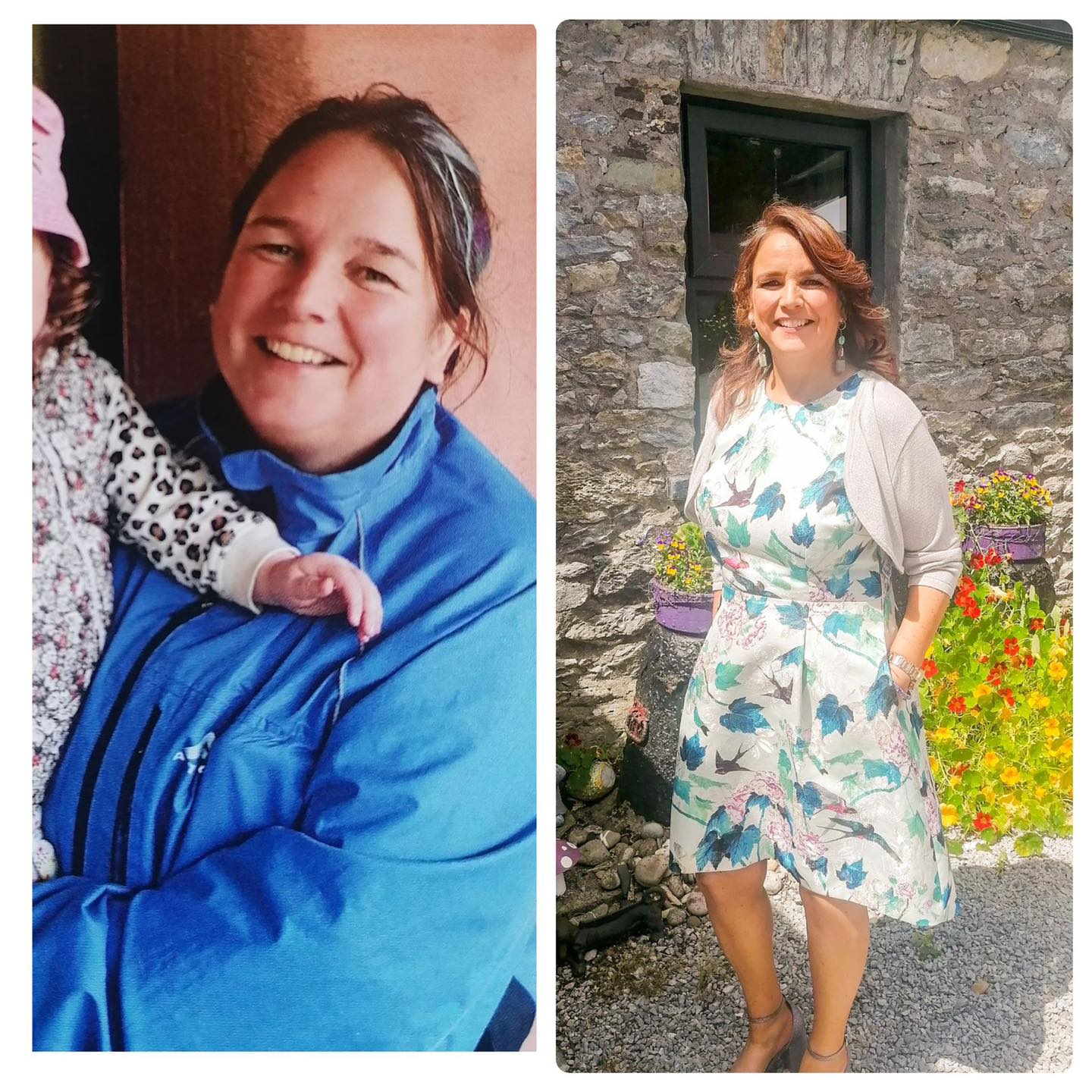 Weight Loss Transformation Success Stories - BodySlims